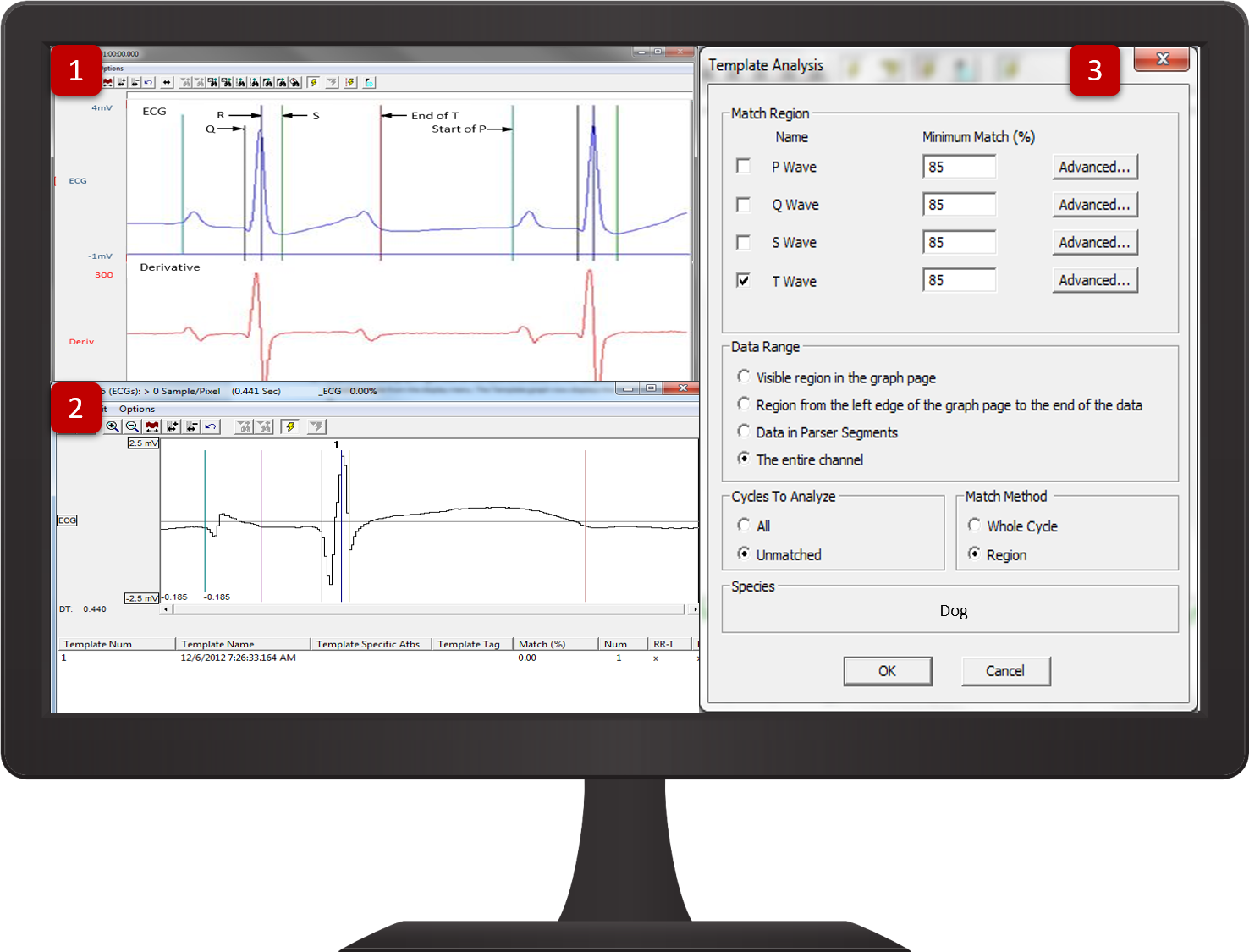 Ecg Analysis Software Ecg Pro