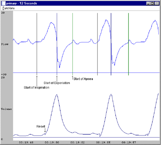 Pulmonary Air Flow and Airway Resistance